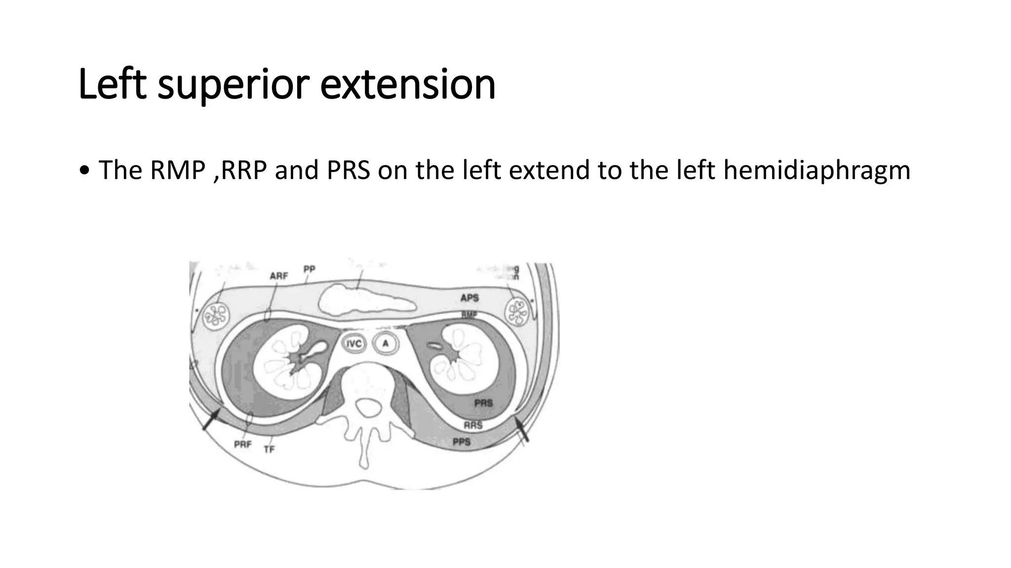 radiological anatomy of retroperitoneum powerpoint | PPTX