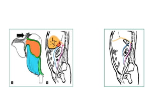 radiological anatomy of retroperitoneum powerpoint | PPTX
