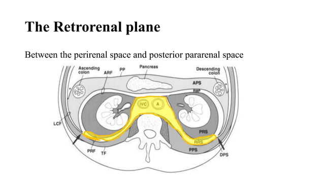 radiological anatomy of retroperitoneum powerpoint | PPT