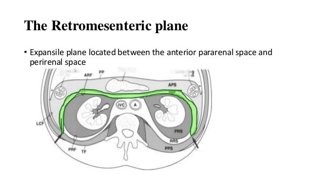 radiological anatomy of retroperitoneum powerpoint