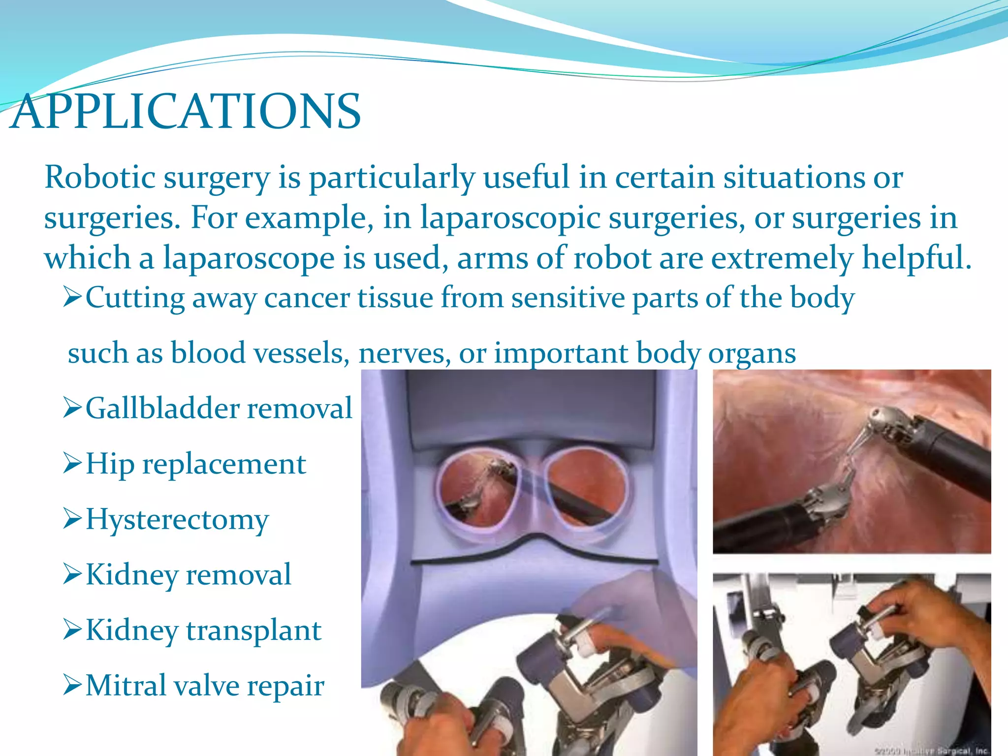 Robotic Surgery by muthugomathy and meenakshi shetti. | PPSX