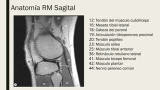 Resonancia Magnética de Rodilla Posicionamiento | PPTX