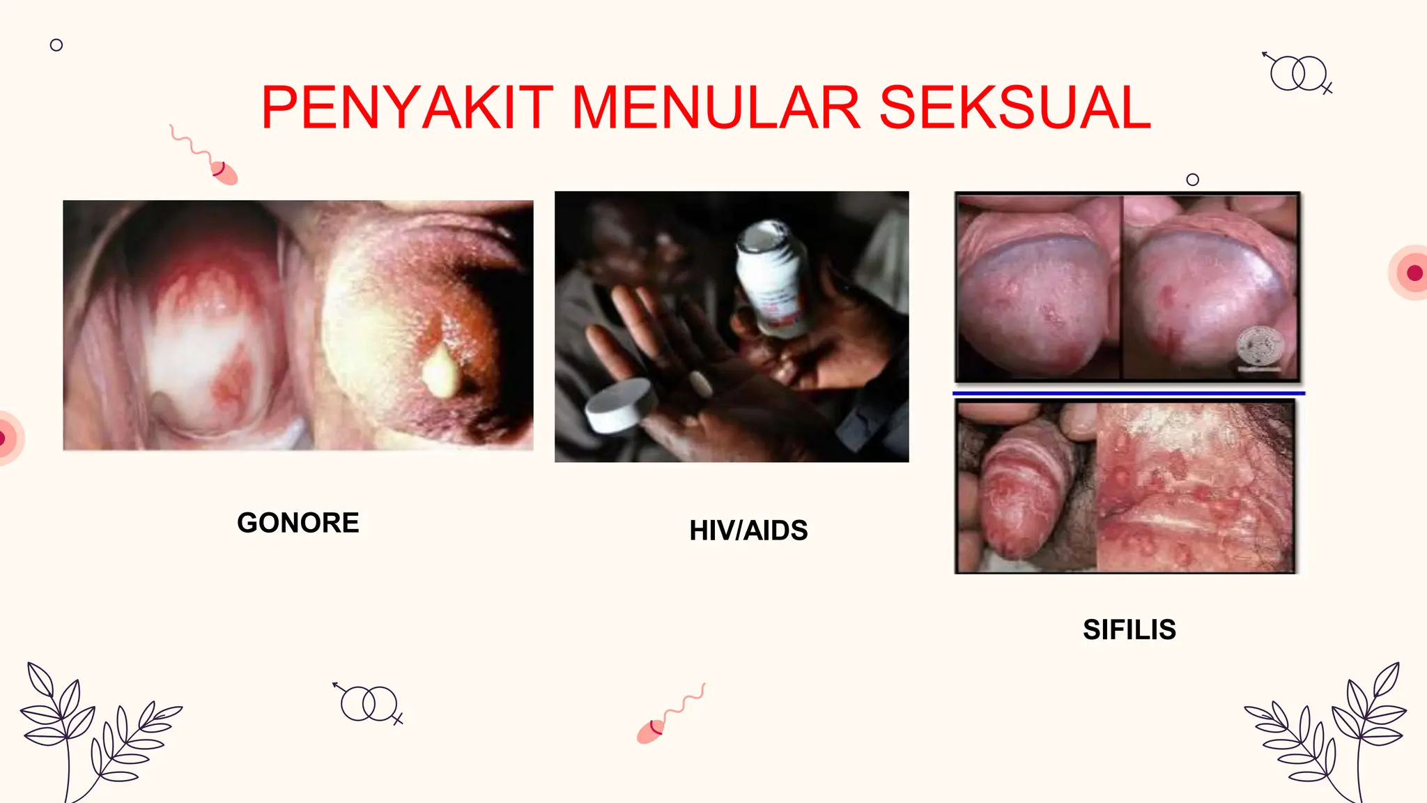 Ppt Sap Sex Education Siti Jazirotul Jannah Pptx