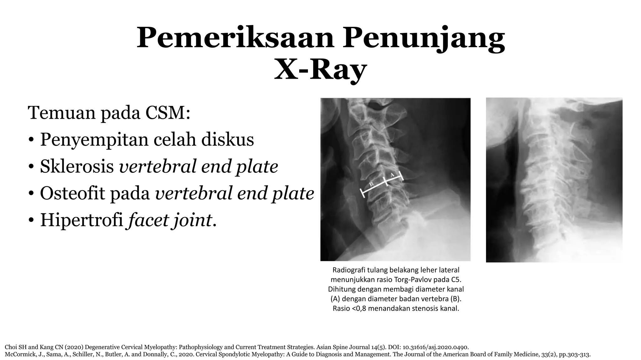 PPT Sarpus ASY penunjang.pptx