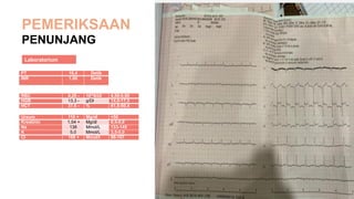 STEMI (ST-elevation myocardial infarction) | PPT