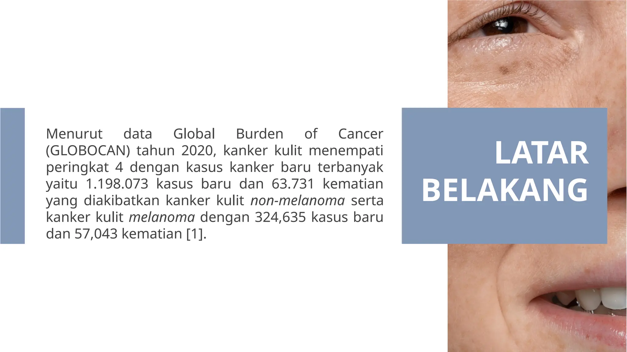 KLASIFIKASI KANKER KULIT PADA CITRA DIGITAL MENGGUNAKAN ALGORITMA ...