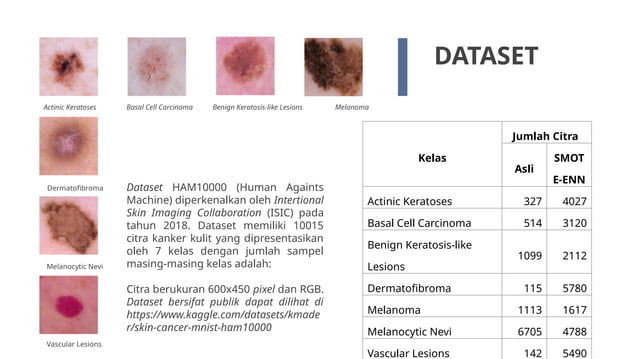 KLASIFIKASI KANKER KULIT PADA CITRA DIGITAL MENGGUNAKAN ALGORITMA ...