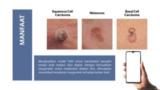 KLASIFIKASI KANKER KULIT PADA CITRA DIGITAL MENGGUNAKAN ALGORITMA ...