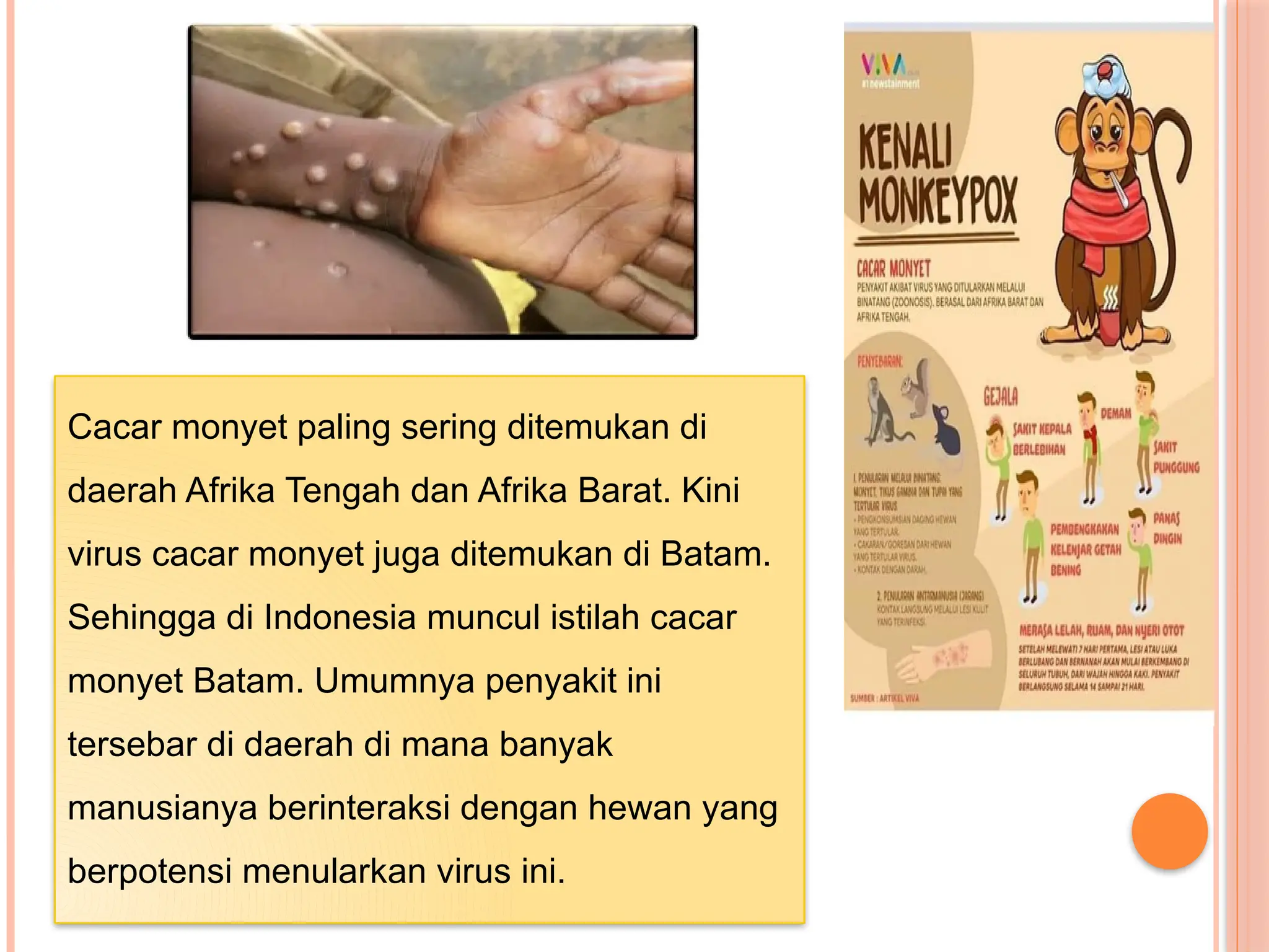 power point tentang penyakit monkey pox (cacar monyet) | PPTX