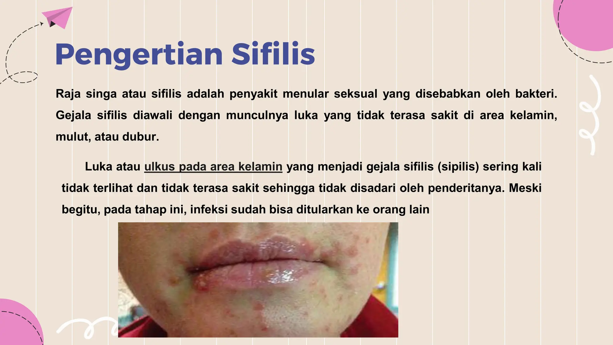 PPT SIFILIS.pptx bahan bacaan masyarakat | PPTX