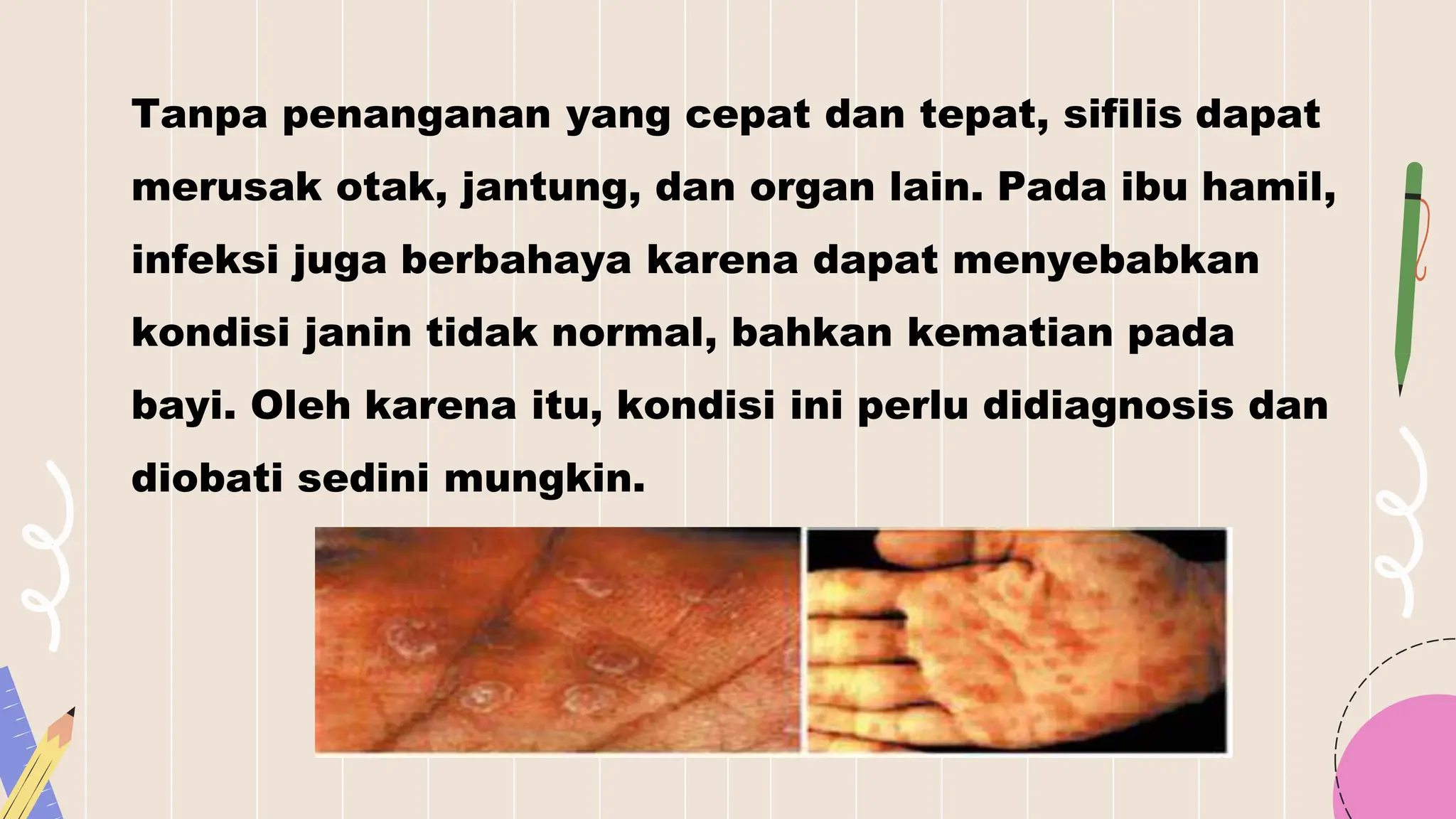 PPT SIFILIS.pptx bahan bacaan masyarakat | PPTX