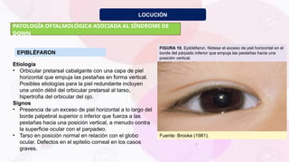 Sindrome de down 1 - Caracteristicas 123 | PPTX