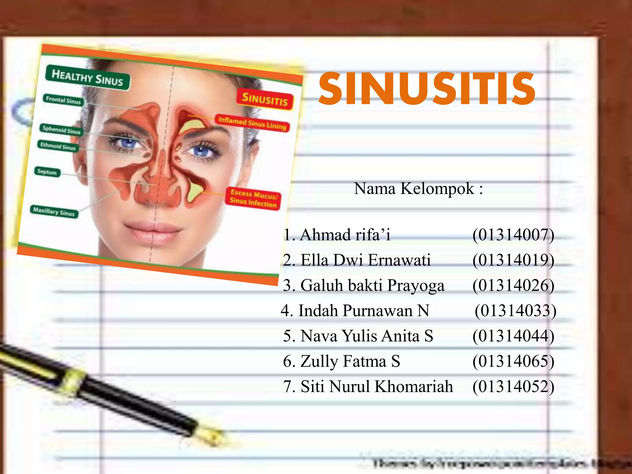 Sinusitis | PPTX