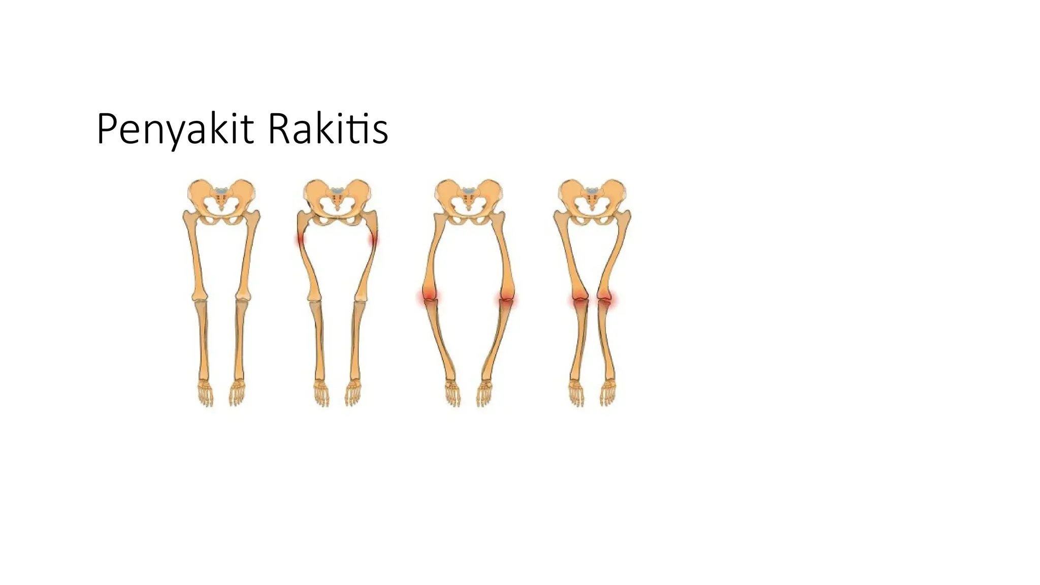 PPT Sistem Gerak Manusia Materi Kelas VI | PPTX