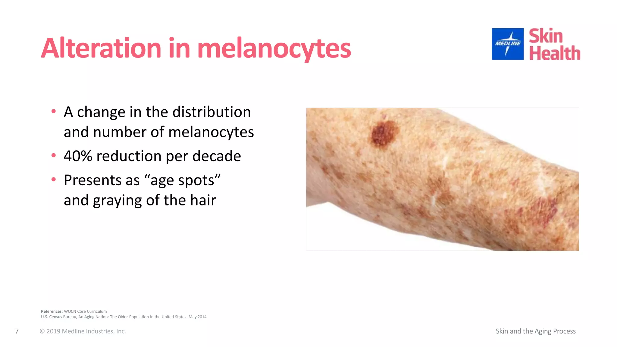 Skin and the Aging Process | PPTX