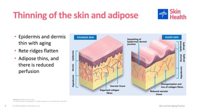 Skin and the Aging Process | PPTX