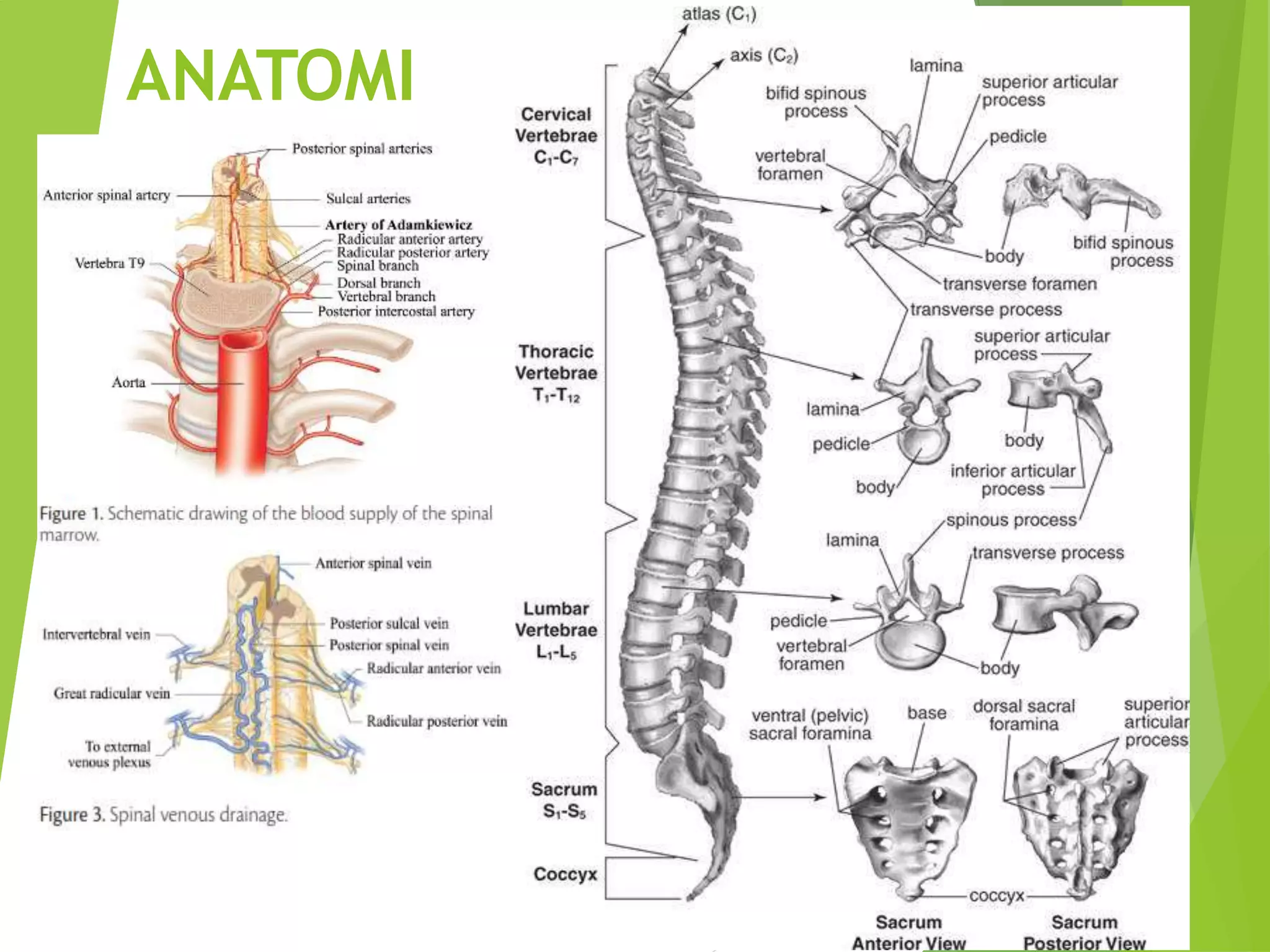 PPT_Spondilitis_TB.ppt