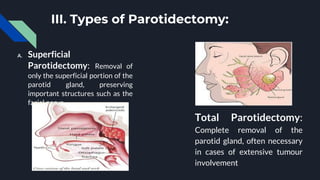 Tonsillectomy coblation surgery in Bangalore | PPT