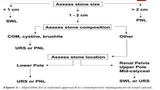 Urinary stone management | PPTX