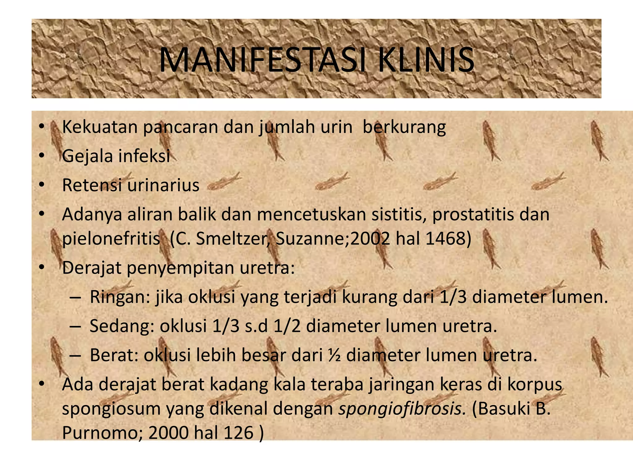striktur uretra | PPTX