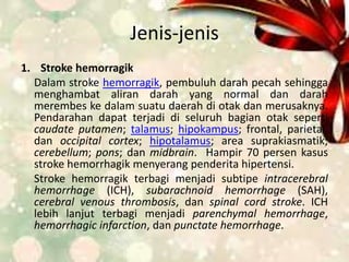 Ppt stroke 2 | PPTX