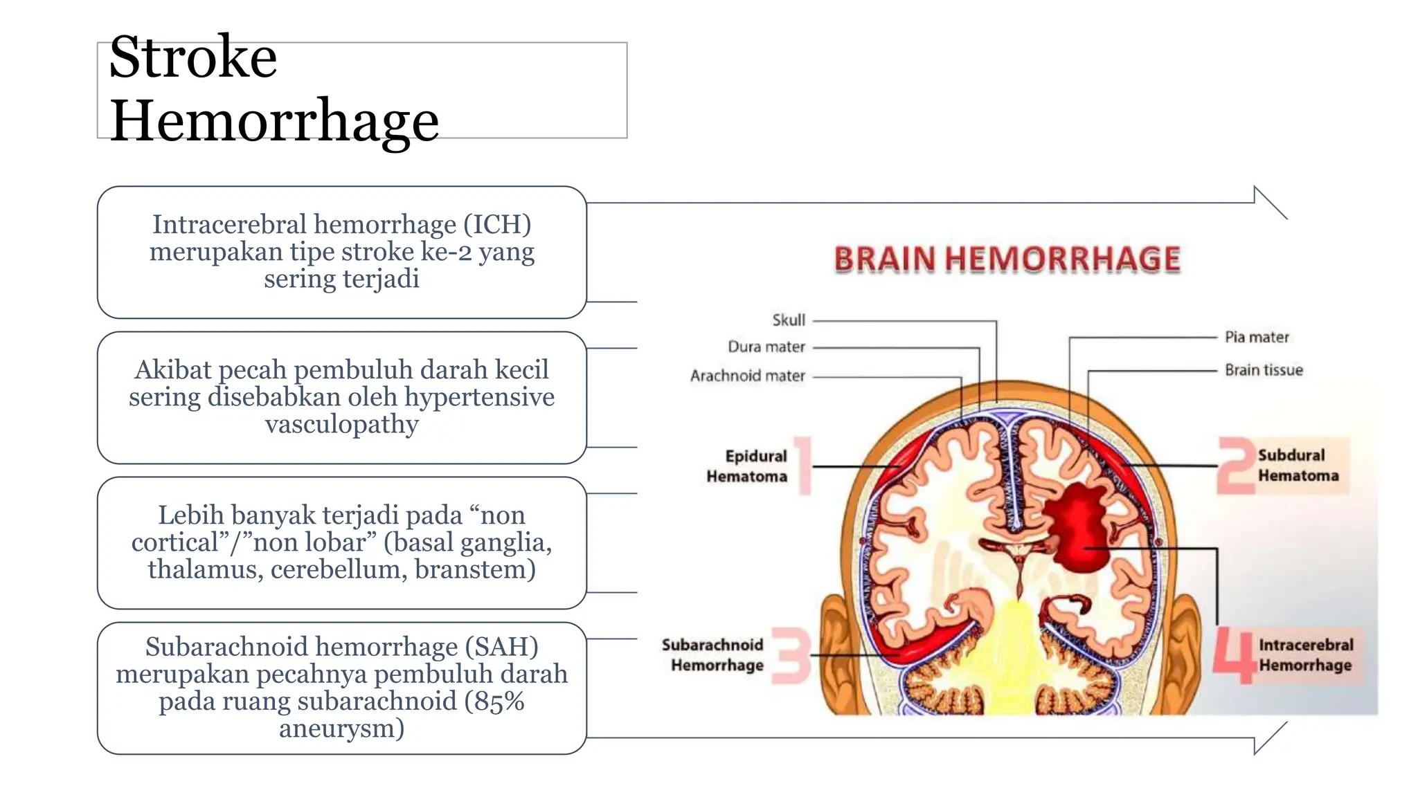 pemaparan power point stroke pada dewasa.pptx