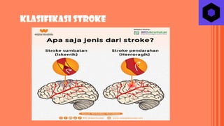 POWER POINT STROKE HEMORAGIK PADA PASIEAN.pptx