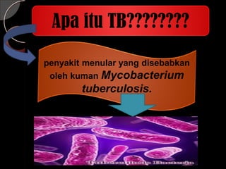 Ppt tb | PPT