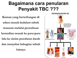 PPT Mengenal dan Mencegah Penyakit Tuberculosis | PDF