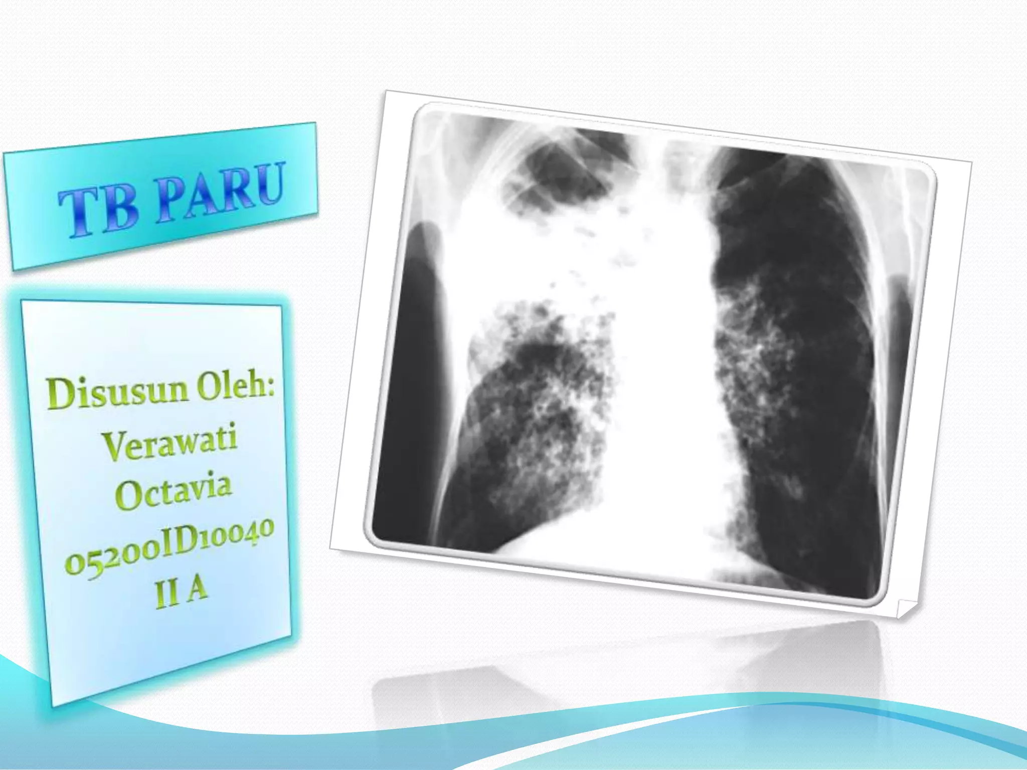 POWERPOINT TB PARU | PPTX