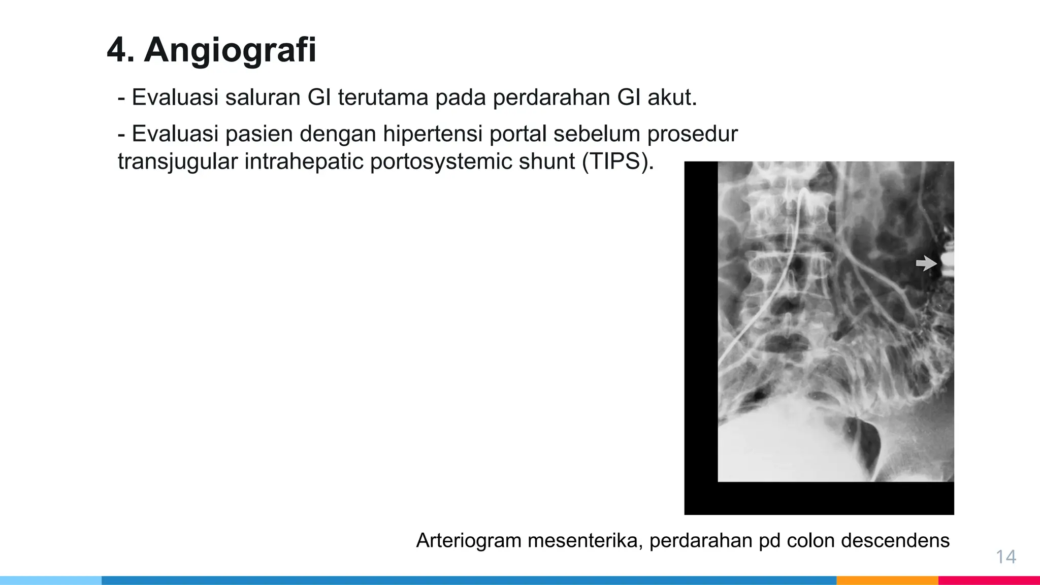 Ppt TBR radiologi gastrointestinal imaging. pptx | PPTX