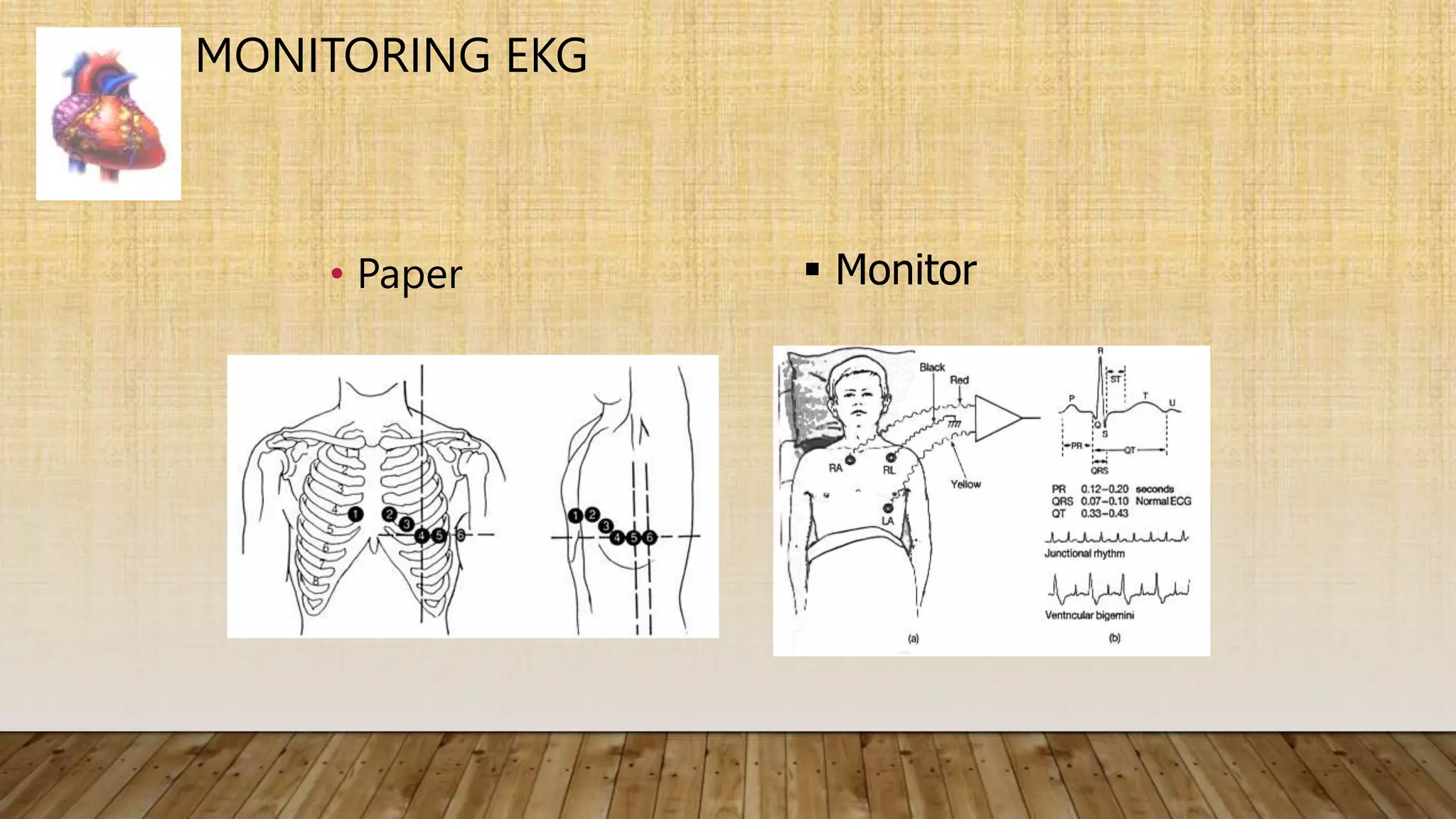 ppt teknik monitor ekg fauzan.ppt