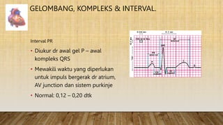 ppt teknik monitor ekg fauzan.ppt