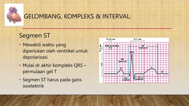 ppt teknik monitor ekg fauzan.ppt