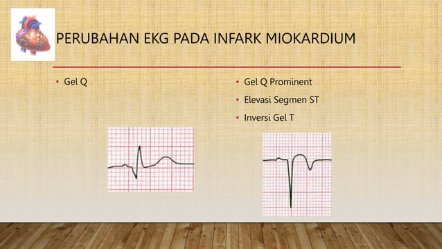 ppt teknik monitor ekg fauzan.ppt