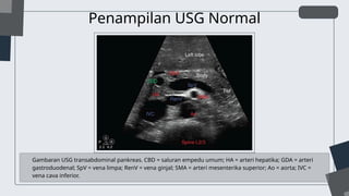 ppt usg pankreas oleh kelas f kelompok 2.pptx