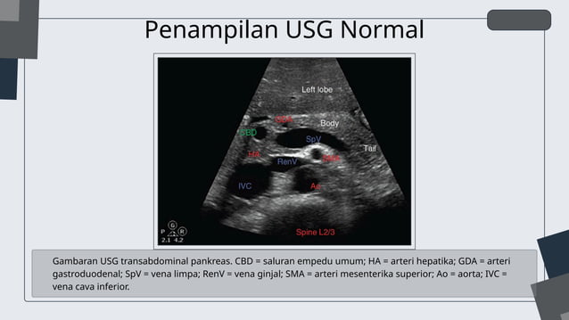 ppt usg pankreas oleh kelas f kelompok 2.pptx