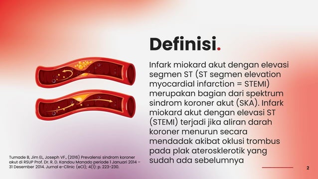 PPT_Terapi Trombolitik pada pasien STEMI .pdf