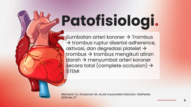 PPT_Terapi Trombolitik pada pasien STEMI .pdf