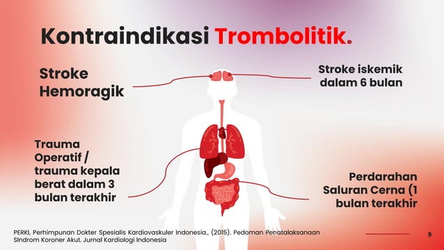 PPT_Terapi Trombolitik pada pasien STEMI .pdf