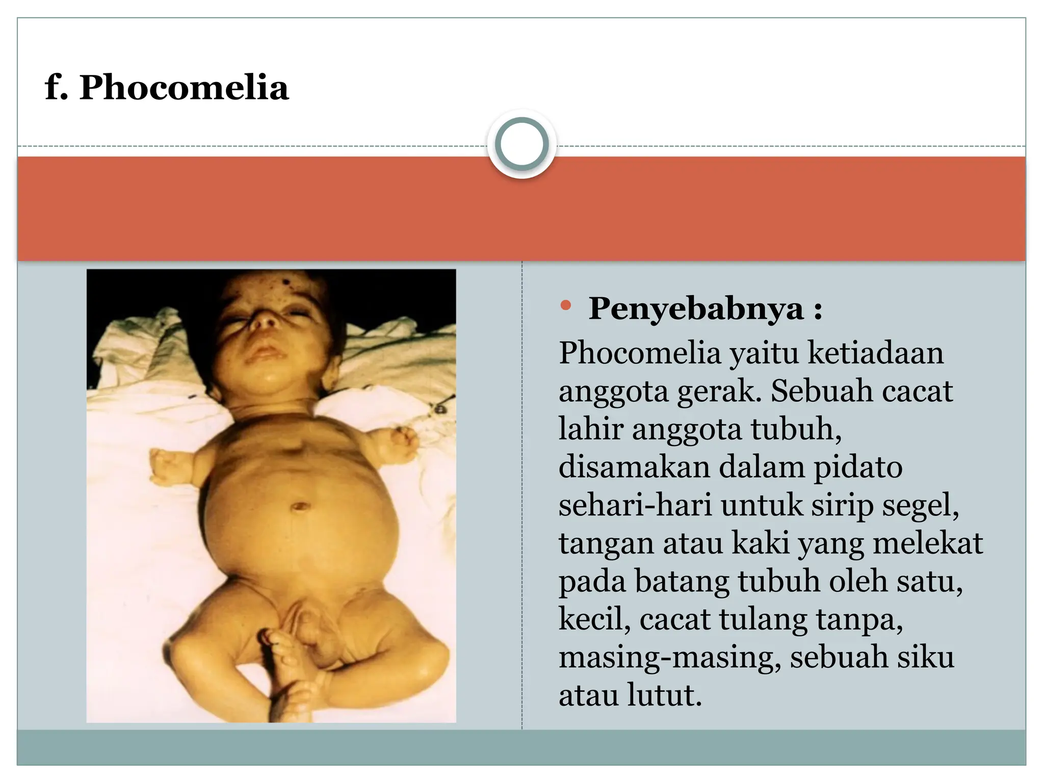 PPT Teratologi......................pptx