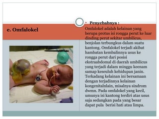 PPT Teratologi......................pptx