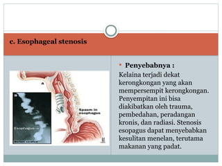 PPT Teratologi......................pptx
