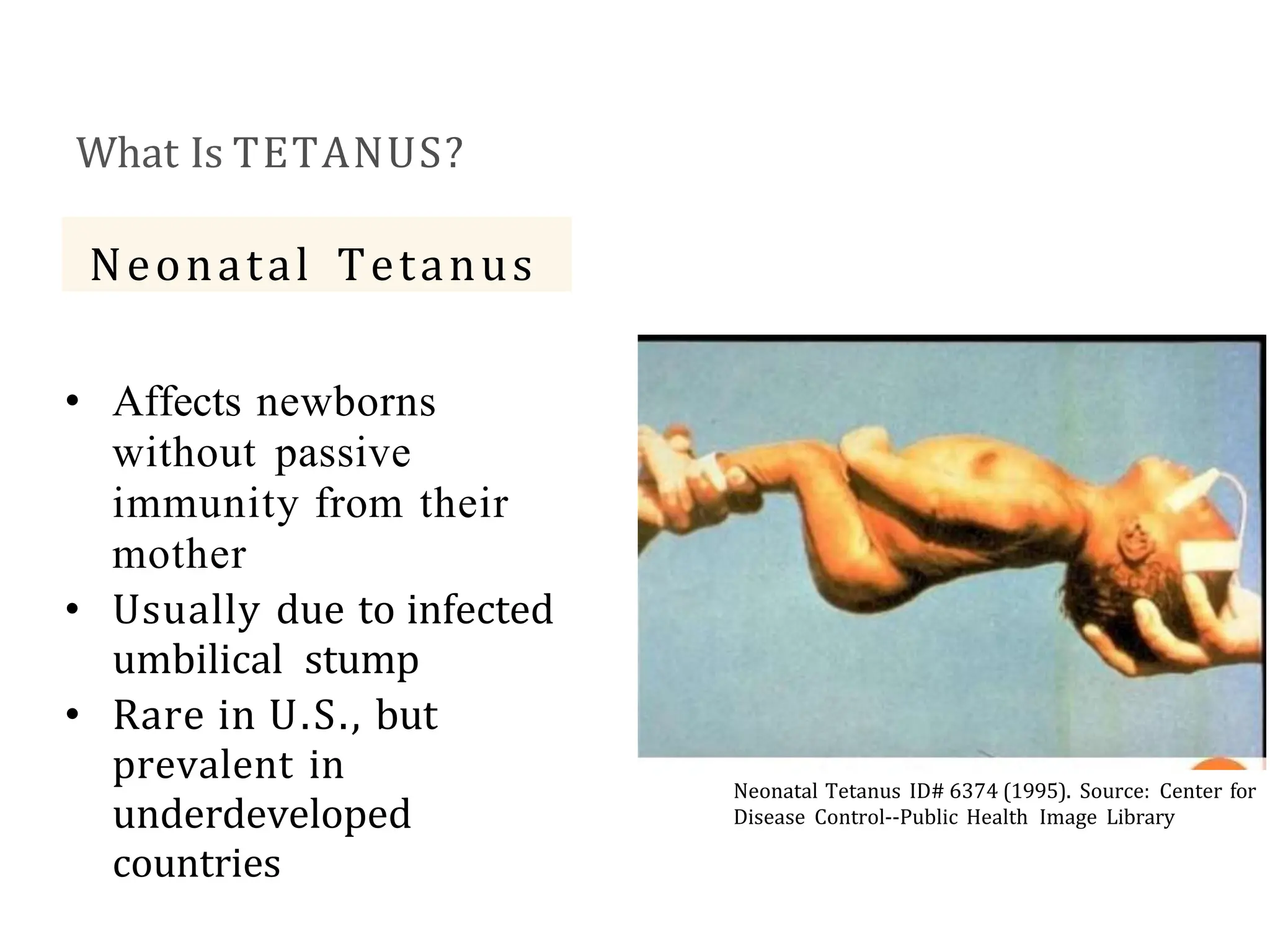 Power Point of Tetanus and vaccine -1.pptx