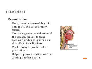 Power Point of Tetanus and vaccine -1.pptx