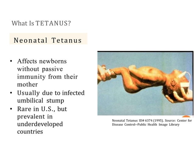 Power Point of Tetanus and vaccine -1.pptx | Brain and Nervous System Disorders | Diseases and ...