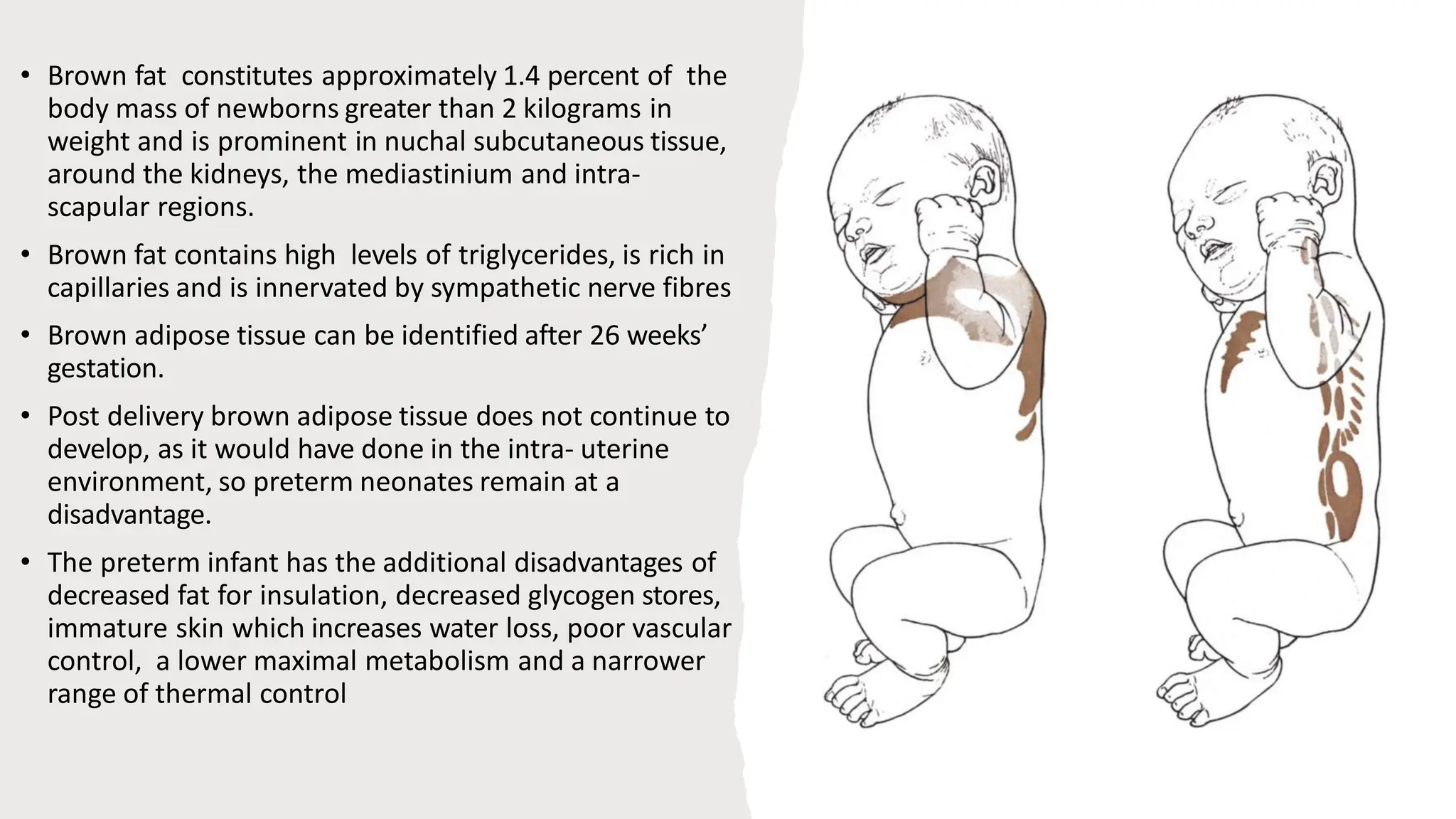 ppt thermo slide neonate presentation.pdf | Pregnancy | Reproductive Health