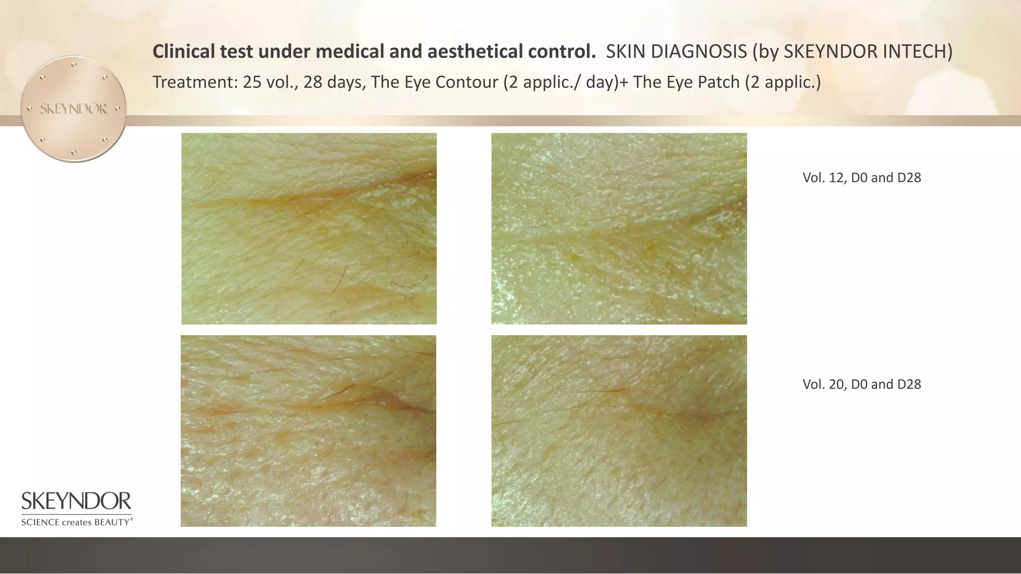 PPT Timeless Prodigy EYES_export EN.pdf | Eye and Vision Conditions ...