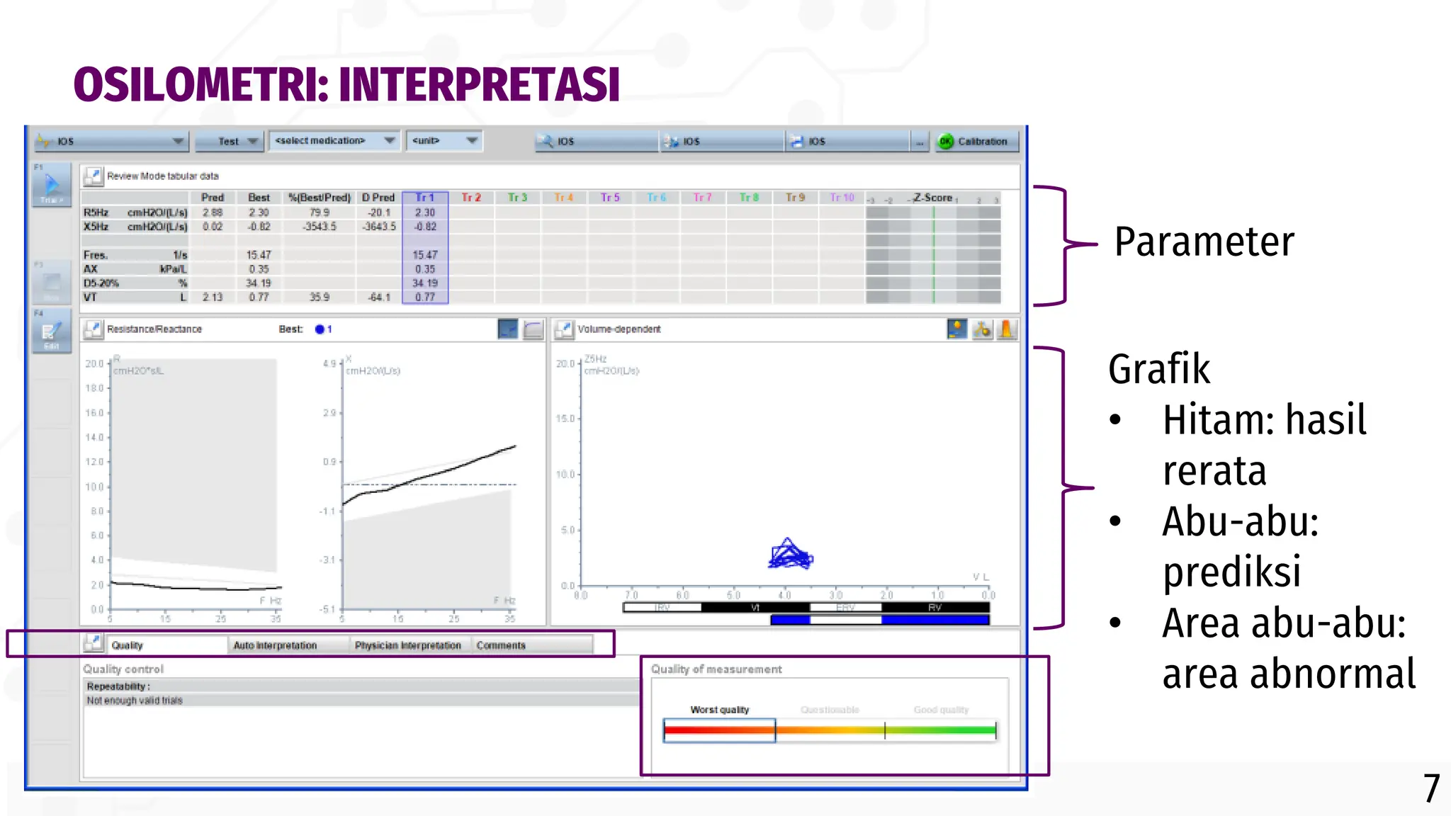 oscillometry for assessing lung function | PDF