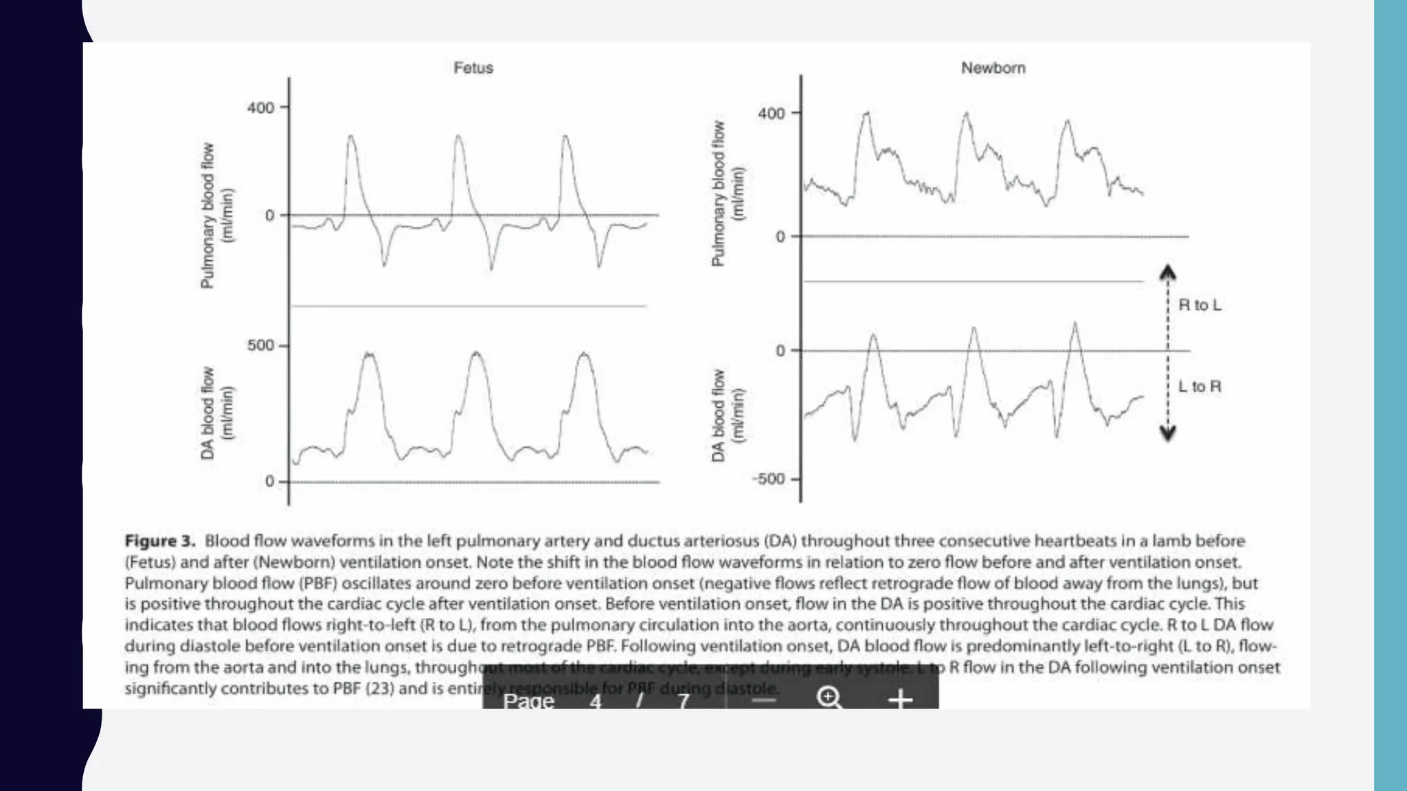 physiology of transition circulation | PPTX